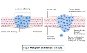 Cancer (GCSE Biology) - Study Mind