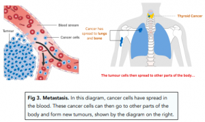 Cancer (GCSE Biology) - Study Mind