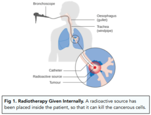 Uses of Nuclear Radiation (GCSE Physics) - Study Mind