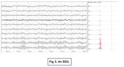 The Brain - Electrical Stimulation and Scans (GCSE Biology) - Study Mind
