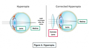The Eye - The Eye: Its Responses - (GCSE Biology) - Study Mind